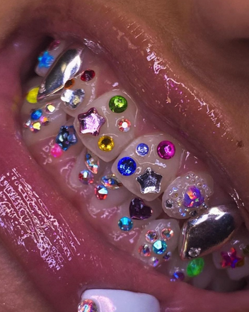 Gemzeez | The Original Diy Tooth Gem Kit